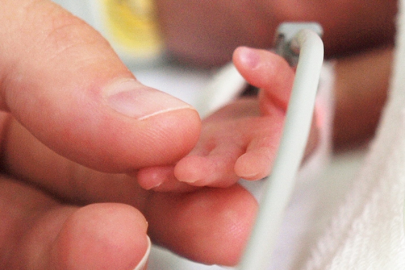 Growth of Preterm and Small Infants: Dispelling Myths - American ...